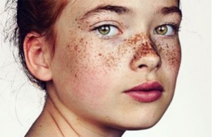 Las mejores fotos de gente pecosa: fotógrafo retrató a decenas para ...