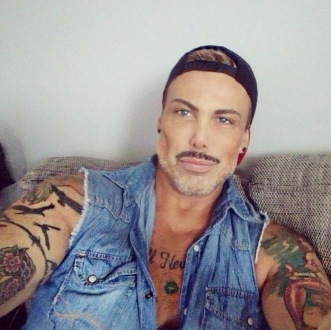 Fotos de Neven Ciganović, el croata que llevó las cirugías a niveles ...