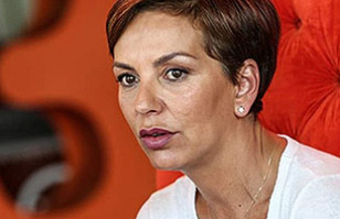 Fran García-Huidobro reveló cuáles son los retoques estéticos que tiene ...